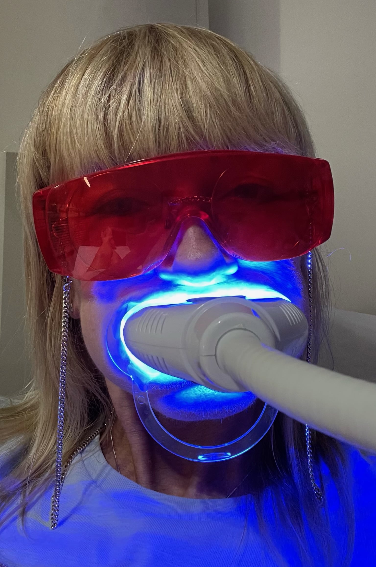 Teeth Whitening — Sanctuary Cosmetic Clinics